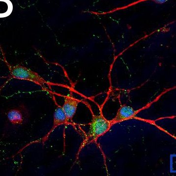 CuraSen Therapeutics Org Chart + Executive Team
